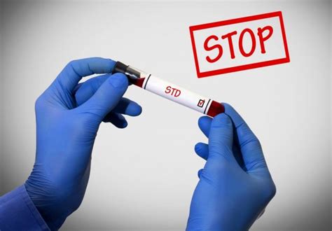 crabs std prevention and risk reduction std