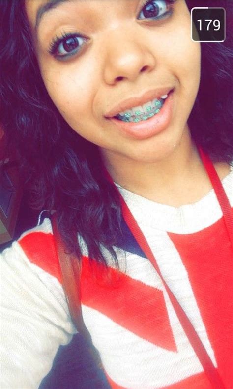 Lime Green Braces Yay Or Nay Green Braces T Shirts For Women Women