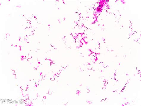 Spirillum Volutans Var Gram Negative Spirochaete Flickr