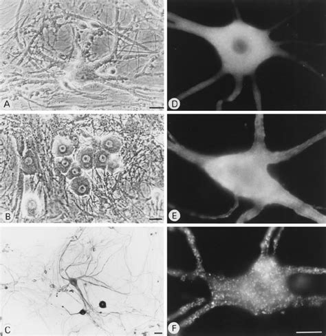 Phase Contrast Micrographs Of A Motor Neuron A And Drg Sensory Phase Contrast Micrographs Of A Motor Neuron A And Drg Sensory