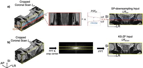Figure 2 From High Resolution 3d Mri With Deep Generative Networks Via Novel Slice Profile