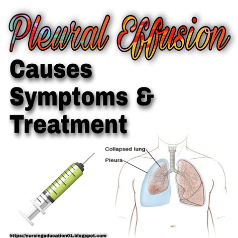 Nursing Study Material Pleural Effusion Cause Symptoms And Treatment