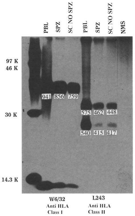HLA Class I And Class II Proteins Are Actively Synthesized In Download Scientific Diagram