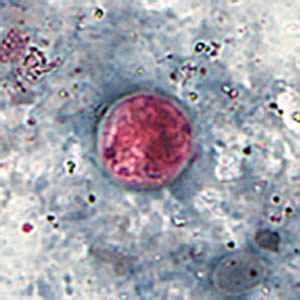 Cdc Dpdx Cyclosporiasis