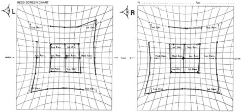 Hess Chart At The First Orthoptic Examination Download Scientific