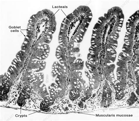 Jejunum Slide Labeled