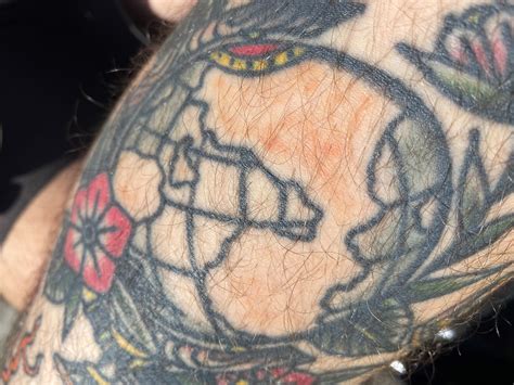 Why Does My Tattoo Look Patchy Stories And Ink®
