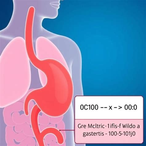 A Comprehensive Guide To Icd 10 Codes For Gastroenteritis Wmwtl