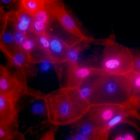 Cancer Cell Lines Can Evolve In The Lab Cell And Molecular Biology