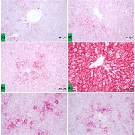 The Triglyceride LDL And HDL Levels The Values Are Expressed As Download Scientific Diagram