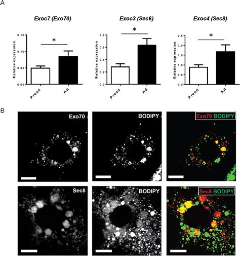 The Expression And Localization Of The Exocyst Complex In Download Scientific Diagram