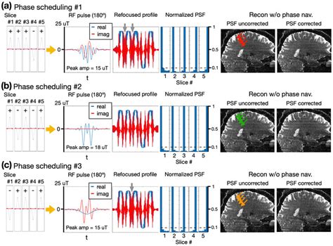 Examination Of Three Types Of Phase Scheduling For Refocusing Pulses
