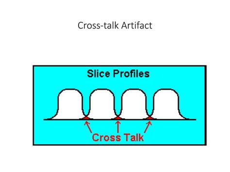 Mri Artifacts Introduction Classification Types Ppt