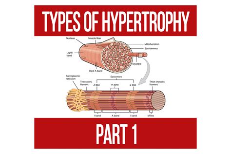 Types Of Hypertrophy Part 1 N1 Training