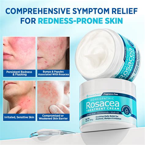 Rosacea Treatment Cream