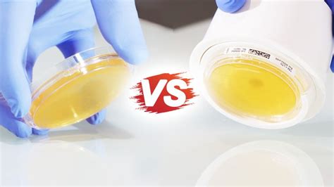 Surface Sampling What About The Standardization Of The Sampling… Alliance Bio Expertise A B E