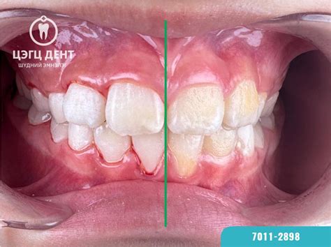 Энэ зургийг сайн хараарай Цэгц Дент шүдний эмнэлэг