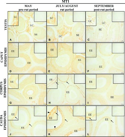 Representative Micrographs Of Melatonin Receptor Mt1 Immunolocalisation