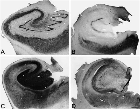 Low Power Photomicrographs From Sections Showing A B The Patterns Download Scientific