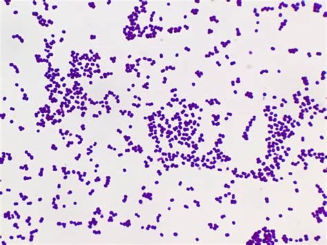 Streptococcus Pyogenes Gram Stain
