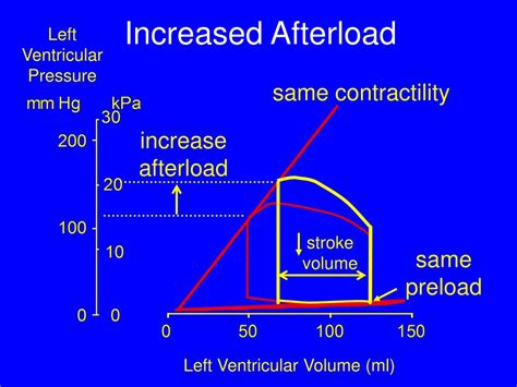 PPT Cardiac Output PowerPoint Presentation Free Download ID
