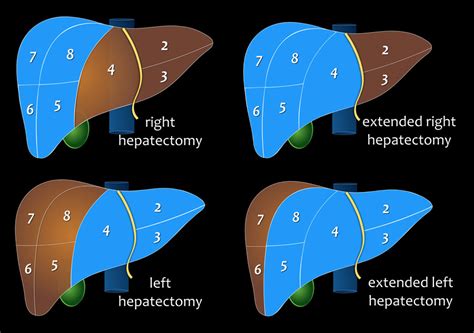 Segmental Liver Anatomy