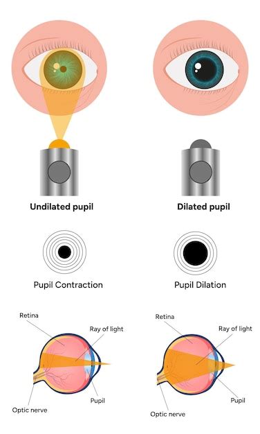 Premium Vector Pupil Size In Different Lighting Dilated Pupil And Undilated Pupil With Eye