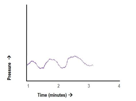 Correlation Of Icp Waveforms With Intracranial Pathology Deranged Physiology