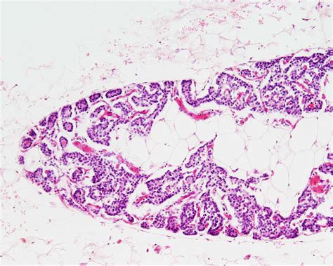 Fileparathyroid Histology 003 Embryology