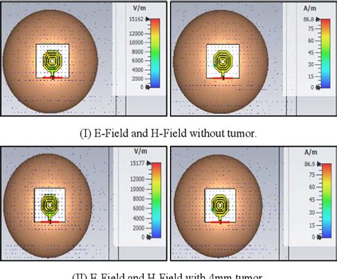 Figure 8 From Design And Analysis Of An Octagonal Slotted Patch