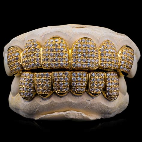 Buy Iced Diamond Grillz For Teeth Online On Sale Today Custom Gold