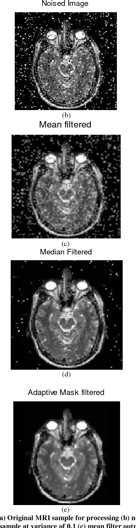 Figure 1 From An Adaptive Learning And Classifier Model In Mri Tumor