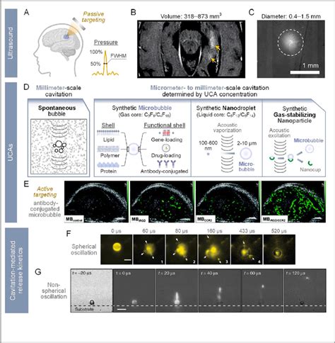 Ultrasound And Its Contrast Agent Mediated Cavitation Events A