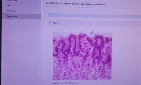 Solved Course Tools Pal Histology Digestive System Lab
