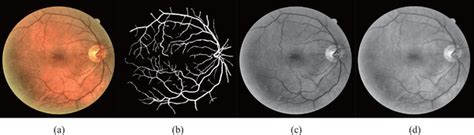 A Retinal Image In Drive Dataset With Corresponding Annotation Download Scientific Diagram