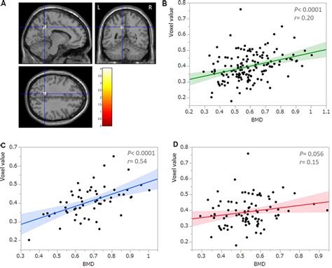 frontiers voxel based morphometry reveals a correlation between bone