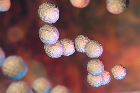 Estreptococo A Motivos Para Preocuparnos Por El Aumento