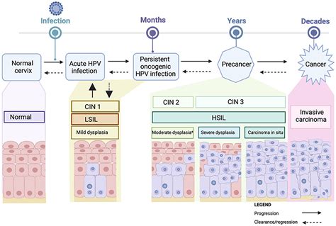 Hpv Cervix