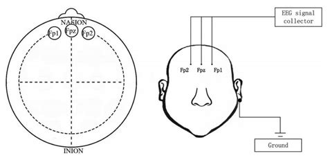 Eeg Electrode Placement