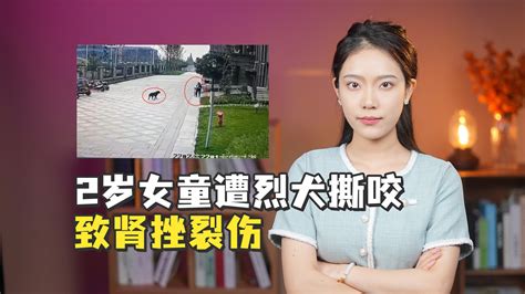 2岁女童遭烈犬撕咬致肾挫裂伤，必须让养狗失责的人付出代价凤凰网资讯凤凰网
