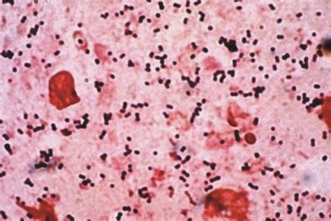 Image Of Gram Stain Of Exudate From Pyodermal Lesion Showing Gram