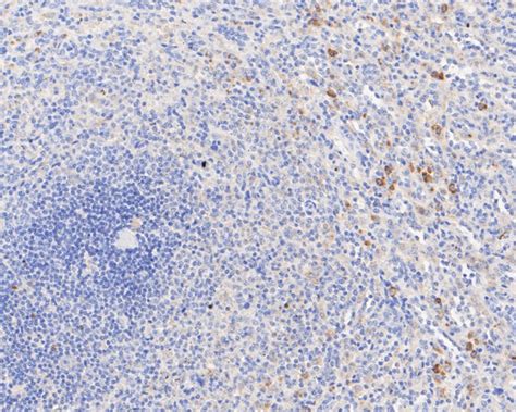 Phospho Pkr T446 Recombinant Rabbit Monoclonal Antibody Sy230 Et1 Huabio