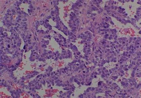 Novus Biologicals™ Human Ovary Tissue Microarray Cancer Slide Human Ovary Tissue Microarray