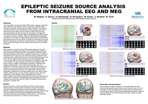 PDF Epileptic Seizure Source Analysis From Intracranial EEG And MEG