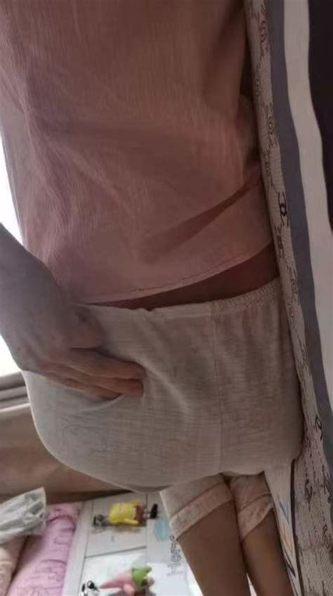 走路久了左边屁股上面一点痛，脚也又麻又辣，就只痛这一侧，要休息一下才能继续走路，请问这是什么问题呢？ 知乎