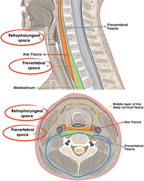 Rosh Review Ct Cross Sectional Anatomy Lung Tissue Histology Labeled