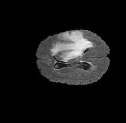 How To Visualize Nifti Image In Python AiHints