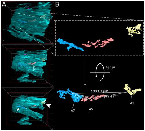 Virtual Segmentation Of Sars Cov 2 Infection Foci At 4 Days