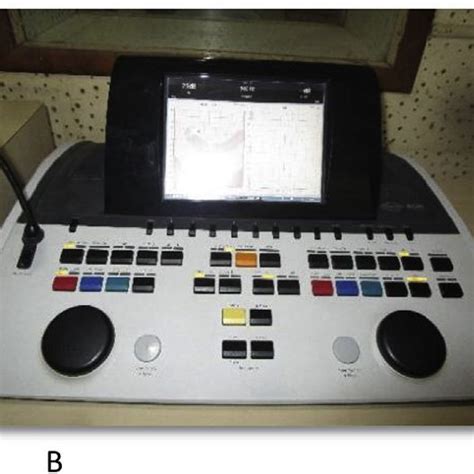 A Sample Graphs Of Tympanometry Type A Eardrum Movement In Normal Download Scientific Diagram