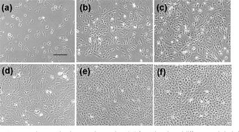 Figure 1 From Insulin Transferrin Selenium Prevent Human Chondrocyte Dedifferentiation And